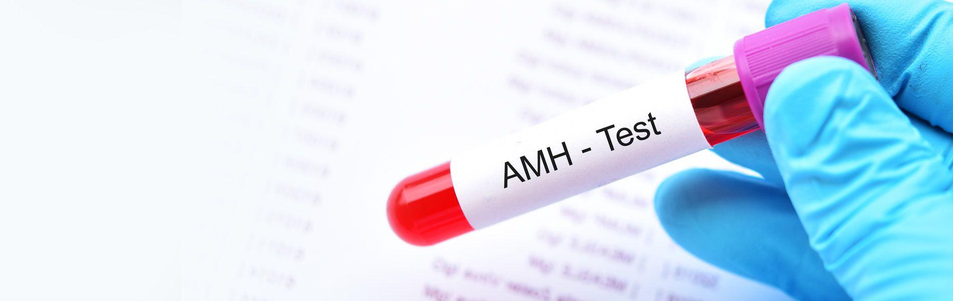 The Anti-Müllerian Hormone (AMH) Test: Purpose, Normal Levels and Test ...