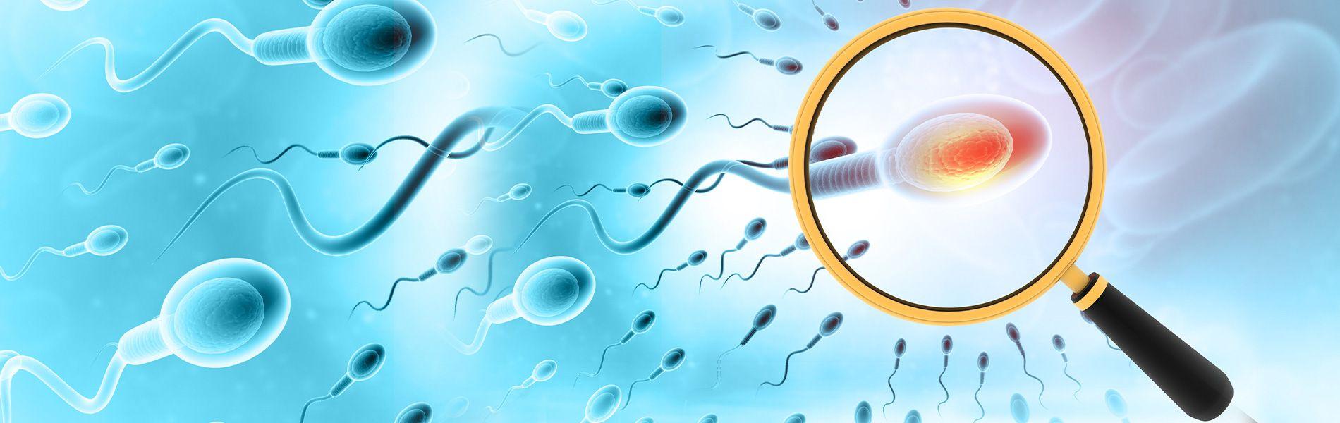 Semen Analysis Report : How to Read a Sperm Analysis Report