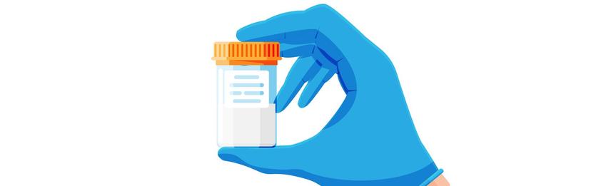 Total Motile Sperm Count | Understanding Your Semen Analysis