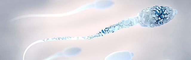 An Overview Of Sperm DNA Fragmentation Index (DFI)