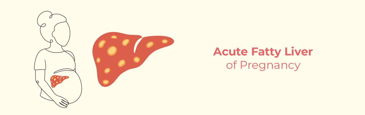Acute Fatty Liver Of Pregnancy: Causes and Symptoms