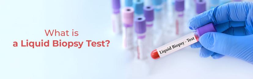 Liquid Biopsy: A Simple Blood Test For Early Cancer Detection