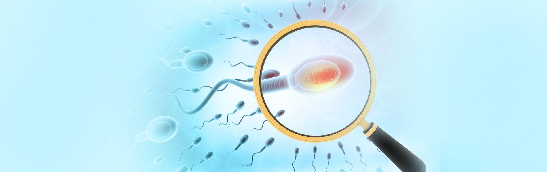 Y-chromosomal Infertility : Types, diagnosis, and treatment options