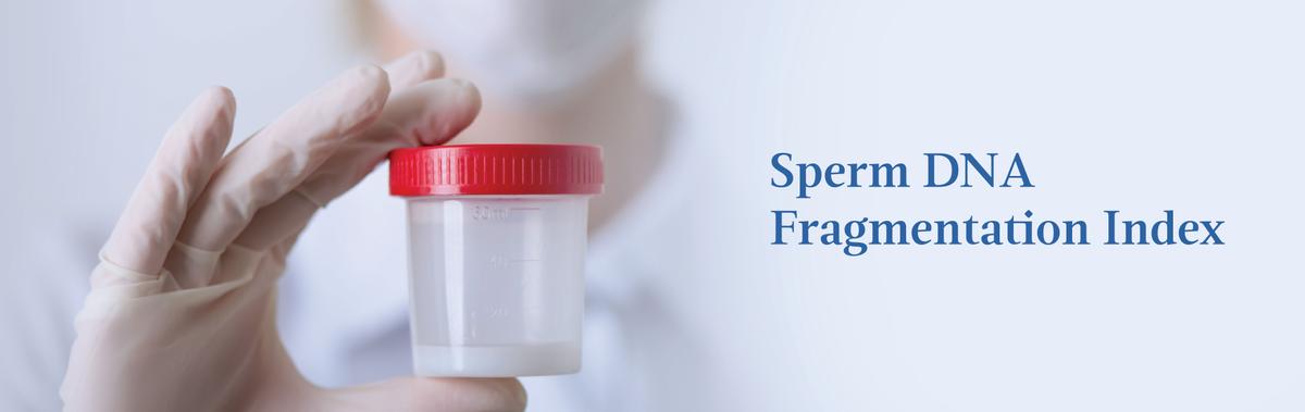 An Overview Of Sperm DNA Fragmentation Index (DFI)